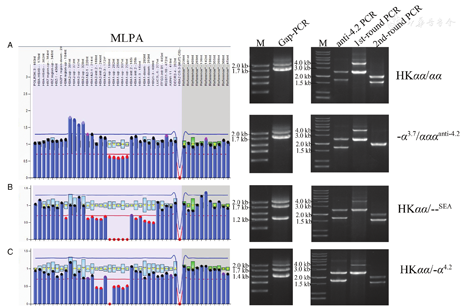 Diagnosis of the accurate genotype of HKαα carriers in patients with ...
