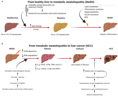 From MAFLD to hepatocellular carcinoma and everything in between