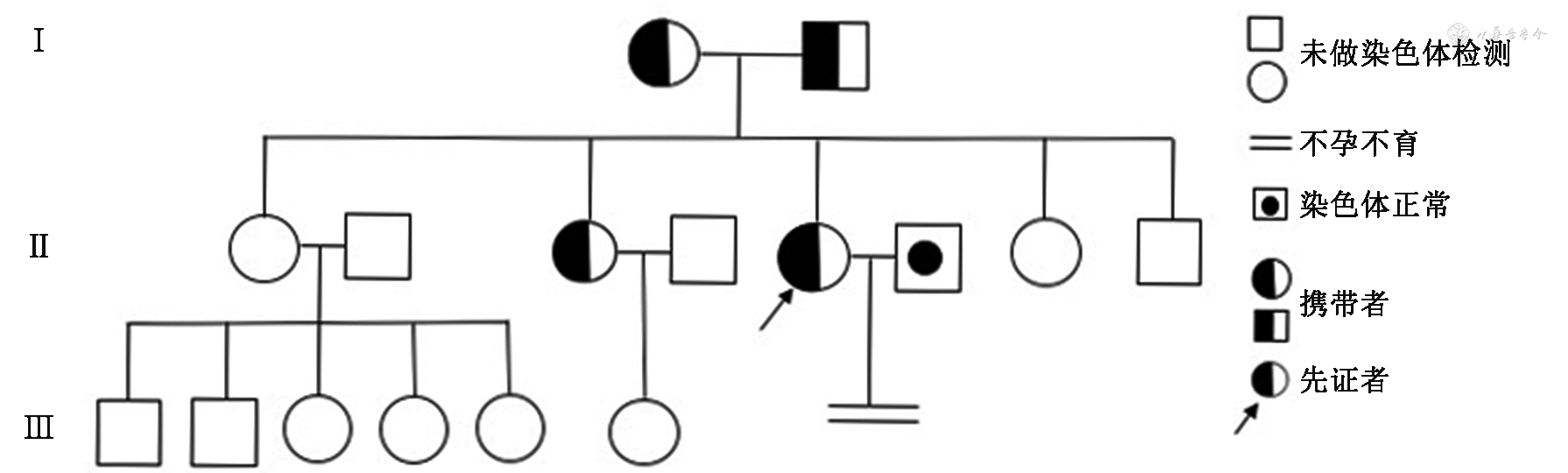 Inv（20）伴不孕症和多囊卵巢综合征一家系