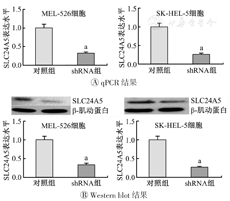 SLC24A5在皮肤黑色素瘤组织中的表达及其临床意义 - 国际生物医学工程杂志