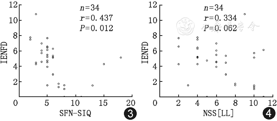 伴小纤维受损周围神经病34例的临床、电生理及皮肤活检研究 - 中华医学杂志