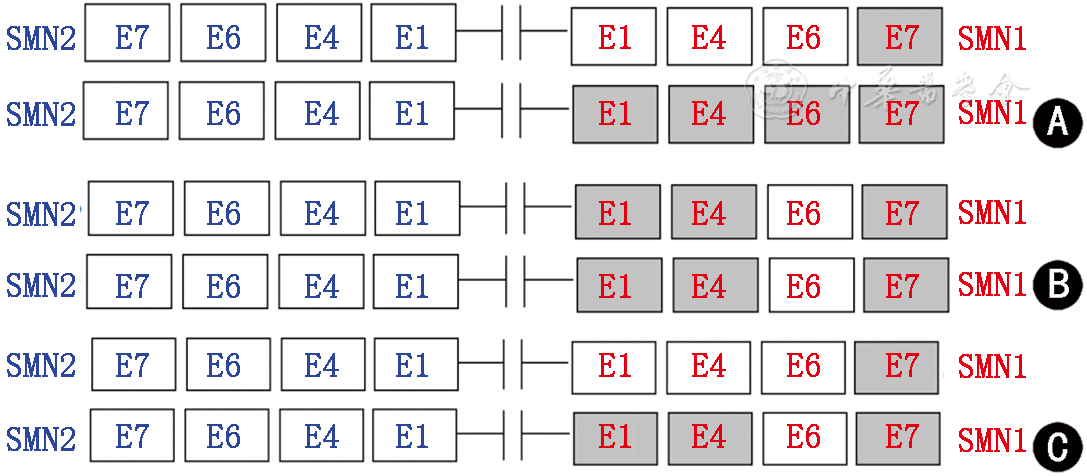 运用MLPA技术分析脊髓性肌萎缩症患儿SMN1基因的部分缺失 - 中华医学杂志