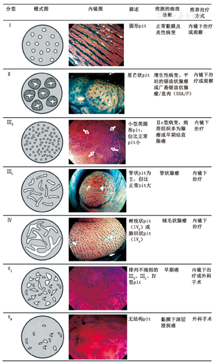 中国早期结直肠癌筛查及内镜诊治指南(2014，北京) - 中华医学杂志