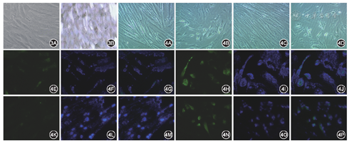 子宫内膜间质细胞共培养促进月经血干细胞向子宫内膜上皮细胞分化的研究 - 中华医学杂志