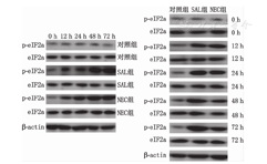 PERK/eIF2a/CHOP信号通路在新生大鼠坏死性小肠结肠炎机制中的作用 - 中华实用儿科临床杂志