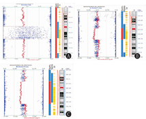 Xp21邻近基因缺失综合征家系分析并文献复习 - 中华实用儿科临床杂志