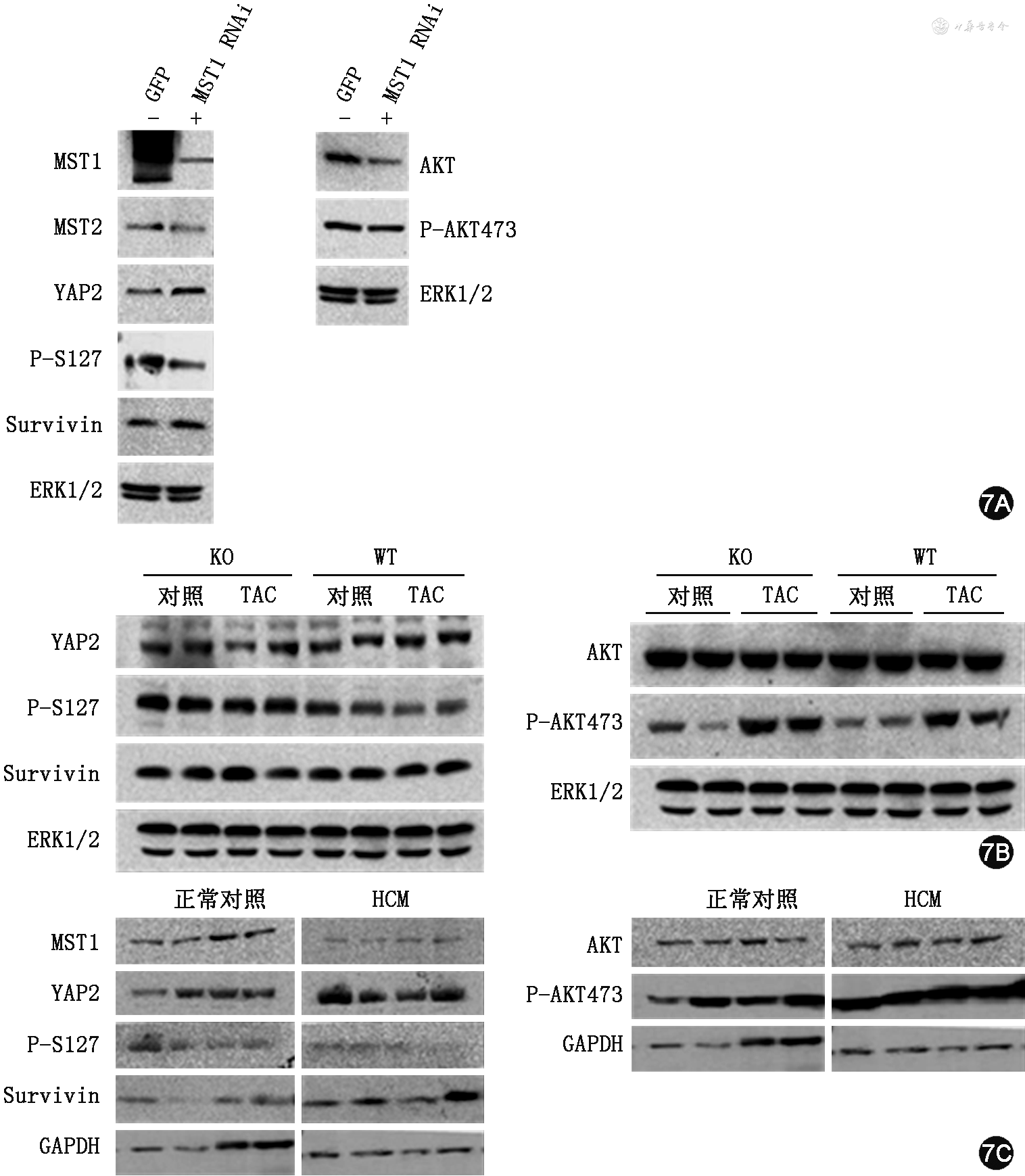 肥厚型心肌病中哺乳动物Ste20样激酶1的表达及其作用机制研究 - 中华心力衰竭和心肌病杂志