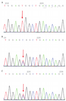 VHL基因突变所致家族性红细胞增多症2型一例及文献复习 - 中华血液学杂志
