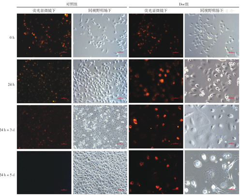 多西紫杉醇诱导的多倍体非小细胞肺癌A549细胞增殖及凋亡特性研究 - 肿瘤研究与临床