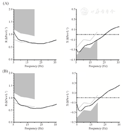 "Reactance inversion" at low frequencies in a child undergoing ...