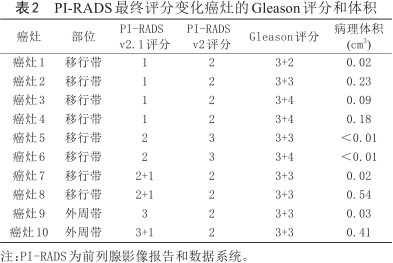 基于前列腺逐层切片病理PI-RADS v2.1与PI-RADS v2的评分比较 - 磁共振成像