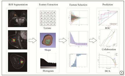 基于DCE-MRI瘤内联合瘤周影像组学模型术前预测乳腺癌Ki-67表达状态的价值 - 磁共振成像