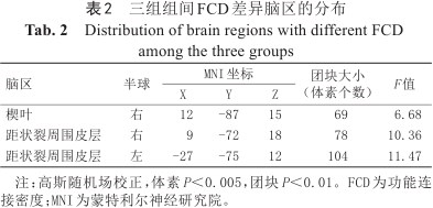 不同程度尼古丁依赖者脑功能连接密度改变的功能磁共振成像研究 - 磁共振成像