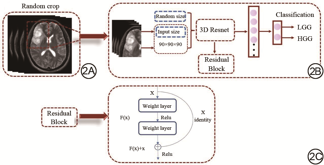 基于多中心MRI的3D-ResNet101深度学习模型预测脑胶质瘤术前分级的研究 - 磁共振成像