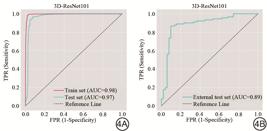 基于多中心MRI的3D-ResNet101深度学习模型预测脑胶质瘤术前分级的研究 - 磁共振成像