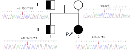 GPT2基因变异和单亲二倍体所致精神发育迟滞49型1例 - 中国临床案例成果数据库
