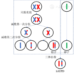 GPT2基因变异和单亲二倍体所致精神发育迟滞49型1例 - 中国临床案例成果数据库