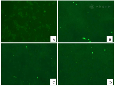 抗神经束蛋白186抗体阳性周围神经病1例 - 中国临床案例成果数据库