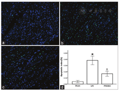 Sigma-1 Receptor Stimulation with PRE-084 Ameliorates Myocardial ...
