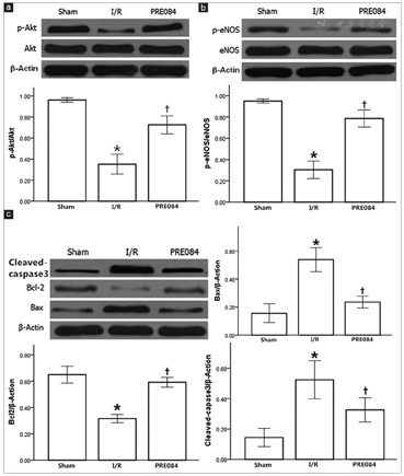 Sigma-1 Receptor Stimulation with PRE-084 Ameliorates Myocardial ...