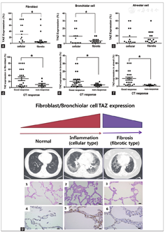 Expression Pattern of the Hippo Pathway Effector TAZ in Cellular and ...
