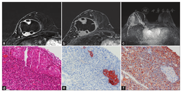 Interesting Dynamic Contrast-Enhanced Magnetic Resonance Imaging ...