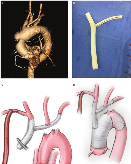 Application of the "branch-first technique" in Sun’s procedure