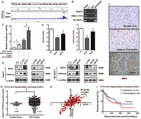 Regulatory factor X5 promotes hepatocellular carcinoma progression by ...