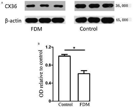 Decreased expression of gap junction delta-2 ( GJD2 ) messenger RNA and connexin 36 protein in ...