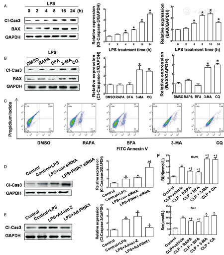 Involvement of phosphatase and tensin homolog-induced putative kinase 1 ...