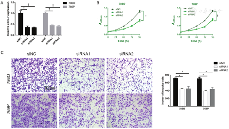 Effect of ciRS-7 expression on clear cell renal cell carcinoma progression