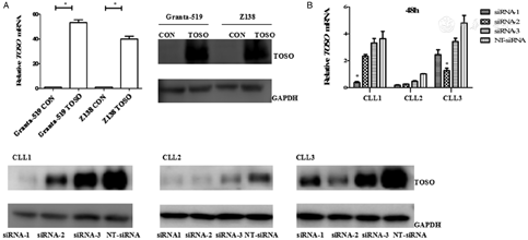 TOSO interacts with SYK and enhances BCR pathway activation in chronic ...