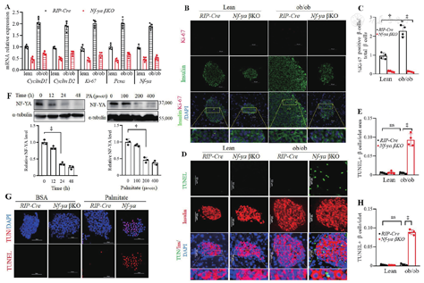 Nuclear factor-Y mediates pancreatic β-cell compensation by repressing ...