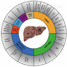 Precision diagnosis of hepatocellular carcinoma