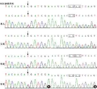 Gitelman综合征一例