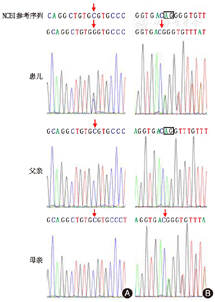 TRMU基因突变致线粒体肝病一例