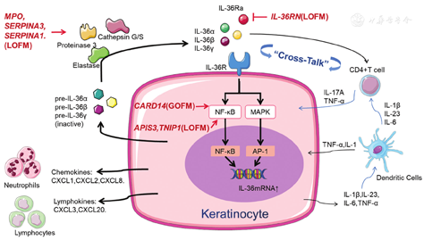 Understanding the Pathogenesis of Generalized Pustular Psoriasis Based on Molecular Genetics and ...