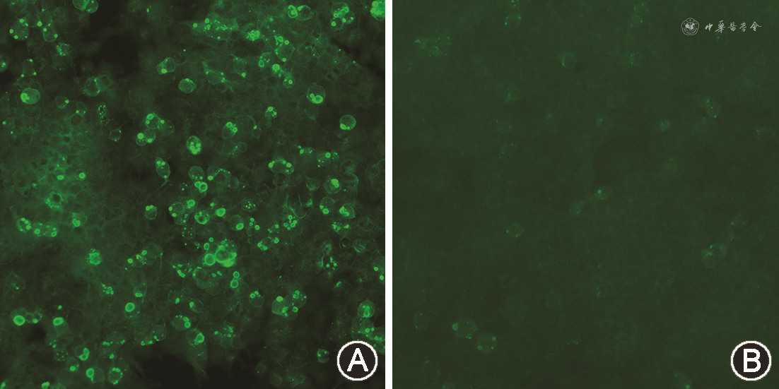 抗Homer3抗体阳性自身免疫性小脑共济失调1例并文献复习 - 中华神经科杂志