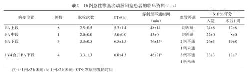 Solitaire AB支架取栓联合Navien导管抽吸治疗急性椎基底动脉闭塞临床研究