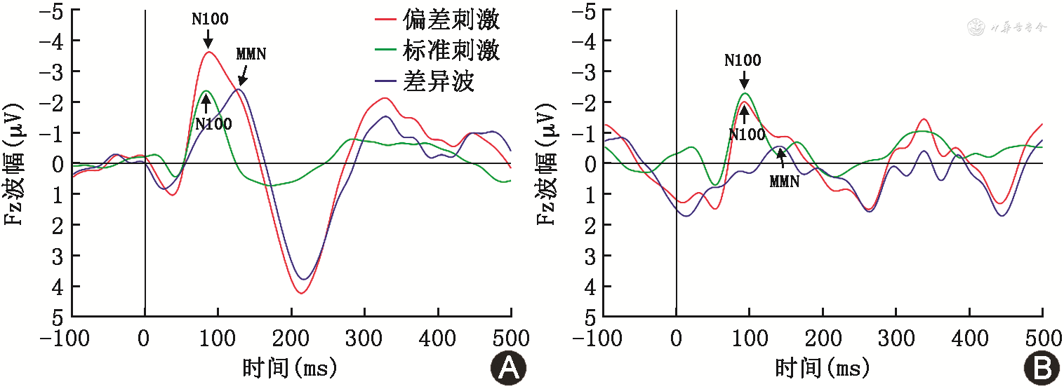 失匹配负波及P3a联合脑电反应性对重型颅脑损伤后昏迷患者预后的预测价值 - 中华医学杂志