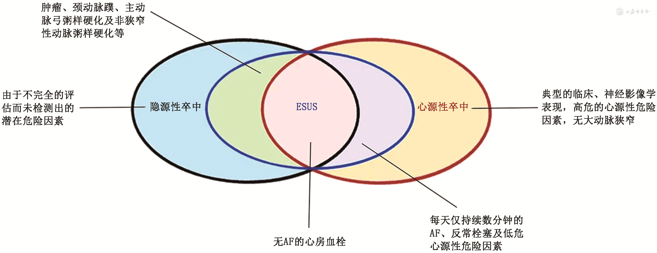 隐源性卒中的诊治研究进展 - 中华医学杂志