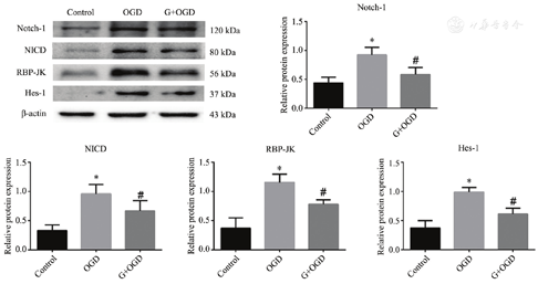 天麻素通过Notch信号通路调控激活的BV2小胶质细胞的研究 - 中国临床解剖学杂志