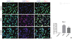 天麻素通过Notch信号通路调控激活的BV2小胶质细胞的研究 - 中国临床解剖学杂志
