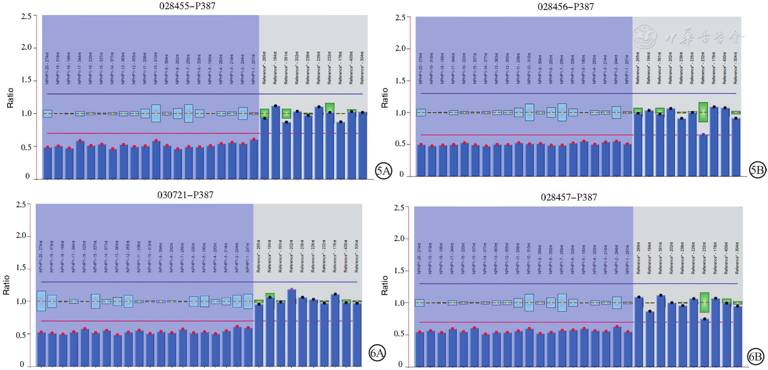 NPHP1基因复合杂合变异所致肾消耗病临床分析 - 中华妇幼临床医学杂志(电子版)