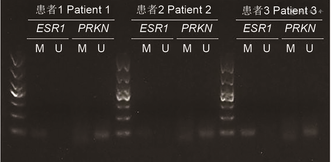 ESR1和PRKN基因甲基化在多囊卵巢综合征发病中的作用及机制研究 - 中华生殖与避孕杂志