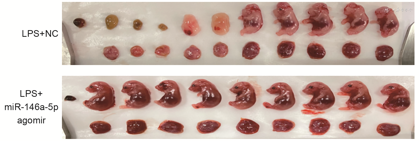MiR-146a-5p对脂多糖诱导的小鼠胚胎吸收和胎鼠发育不良的改善作用及其机制初探 - 中华生殖与避孕杂志