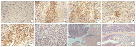 RECK及MMP-2、MMP-9在神经母细胞瘤组织中的表达与肿瘤侵袭转移研究