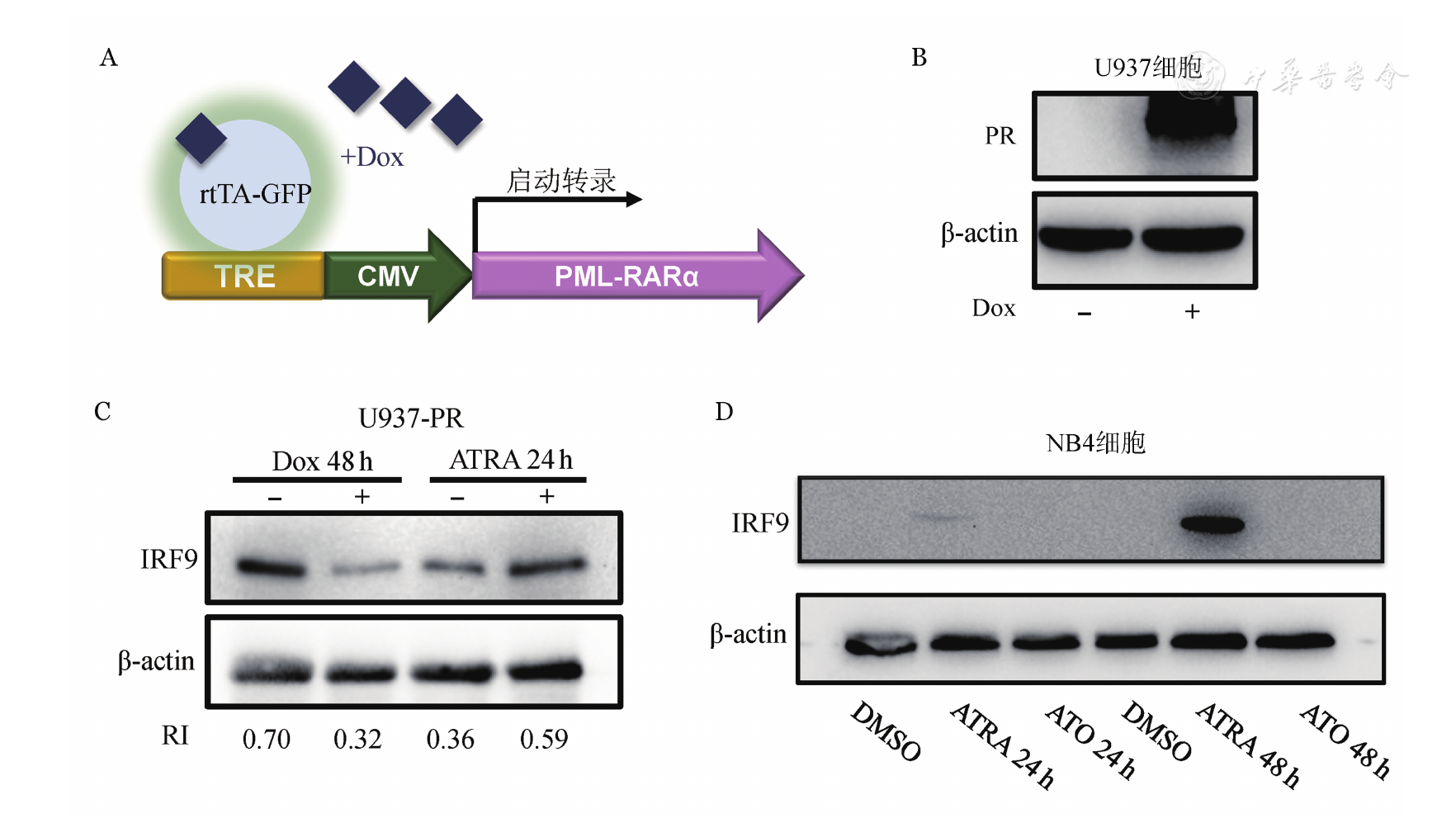 IRF9对伴PML-RARα急性早幼粒细胞白血病细胞生物学功能的影响 - 中华血液学杂志