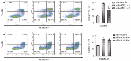 hnRNP U在急性髓系白血病中临床意义及致病机制研究 - 中华血液学杂志