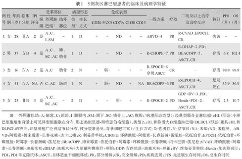 灰区淋巴瘤5例报告并文献复习 - 中华血液学杂志